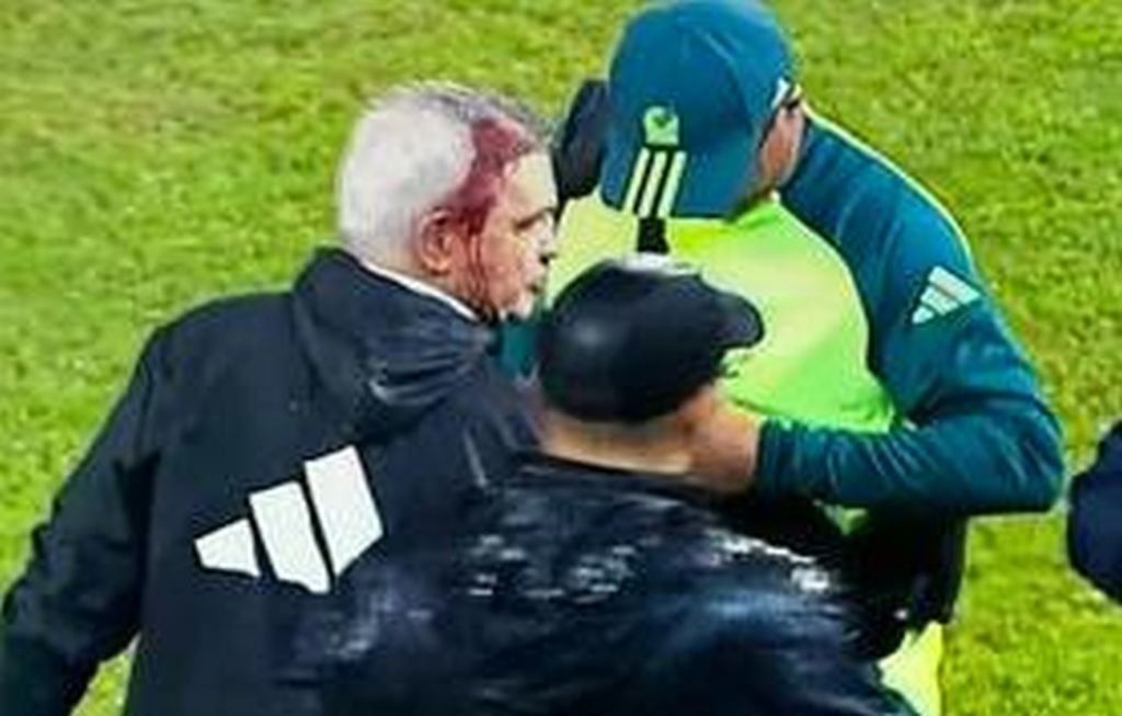 México pierde 2-0 con Honduras y Javier Aguirre sale descalabrado ...